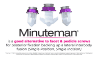 The Minuteman Procedure - The IVP Group